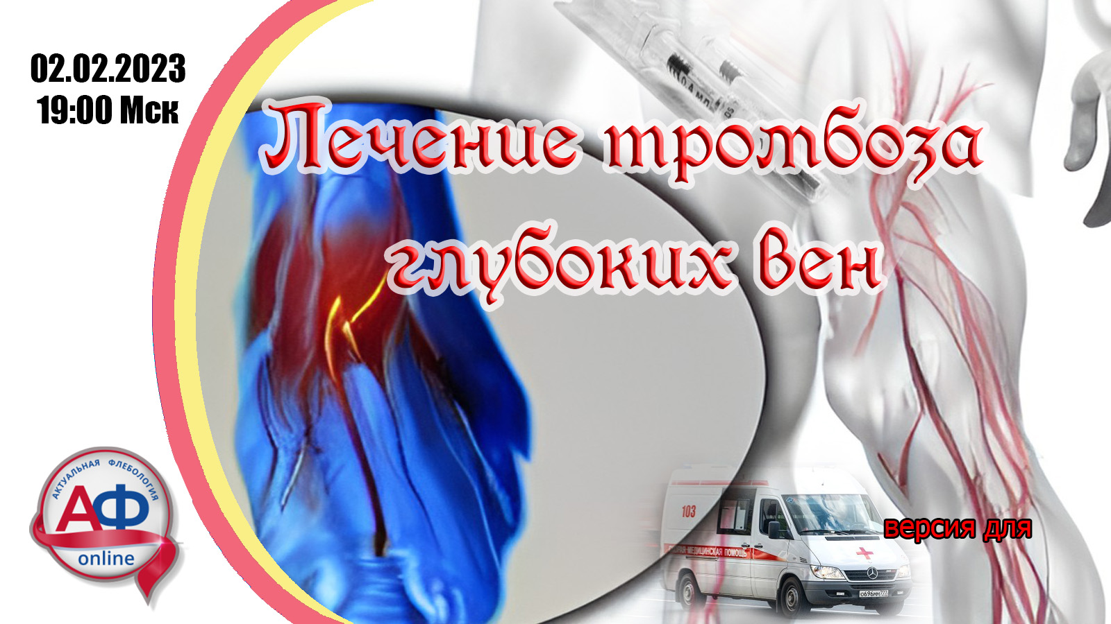 Лечение тромбоза глубоких вен (версия для амбулаторных хирургов)